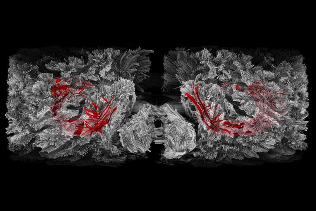 Learning Planet Institute talents at the Saint-Étienne International ...